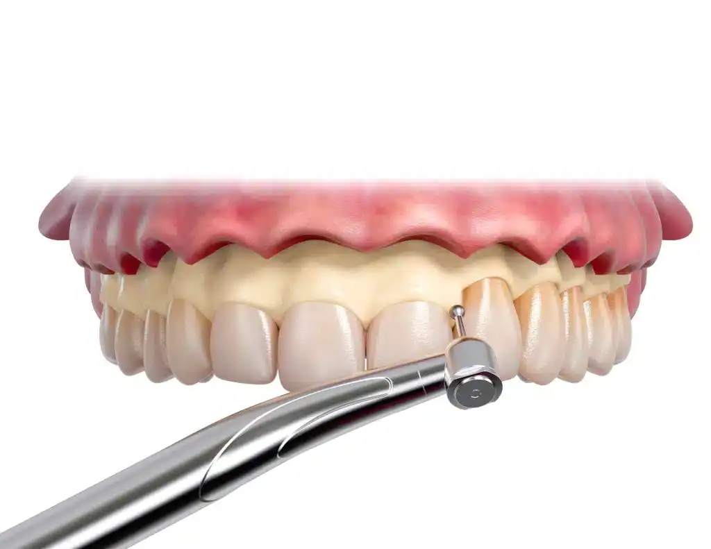 Expert Gum Disease Treatments At Aptos Periodontics