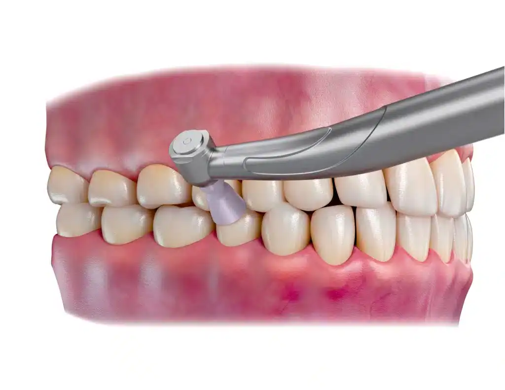 Expert Gum Disease Treatments At Aptos Periodontics
